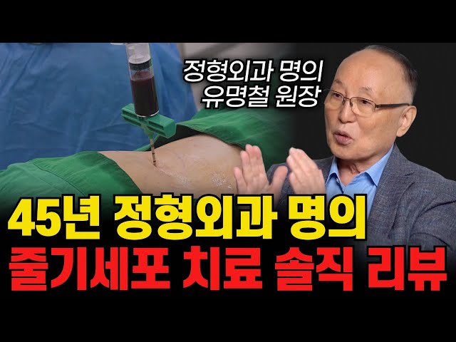 무릎, 관절 줄기세포 치료! 비싼만큼 효과 있을까? | 정병원 유명철 원장